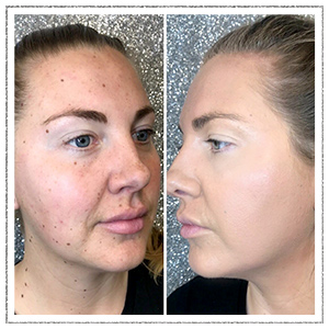 Aesthetics – House of Boo